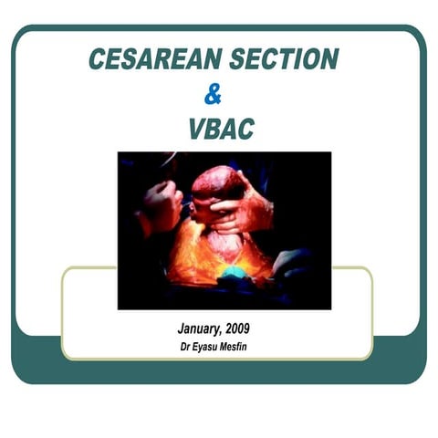 C-S & VBAC.ppt vaginal birth after cs zr | PPT