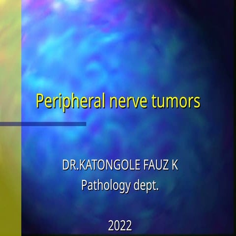 a slide about Tumors of peripheral nerves.ppt