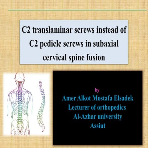 C2 translaminar screw as an alternative option for C2 pedicle screw in ...