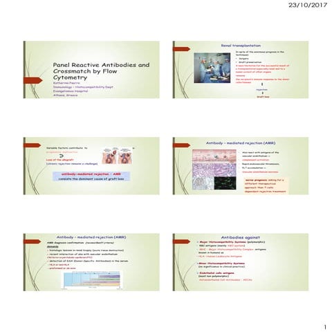 Luminex Single Antigen Bead Assay | PPTX