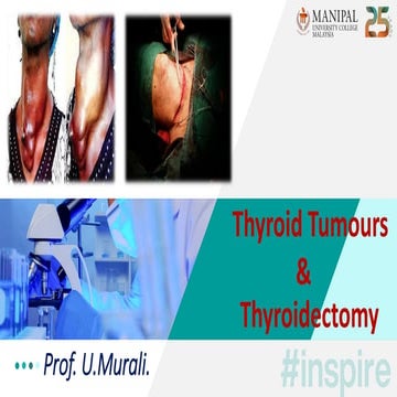 Thyroid Tumours - Malignant & Thyroidectomy | PDF