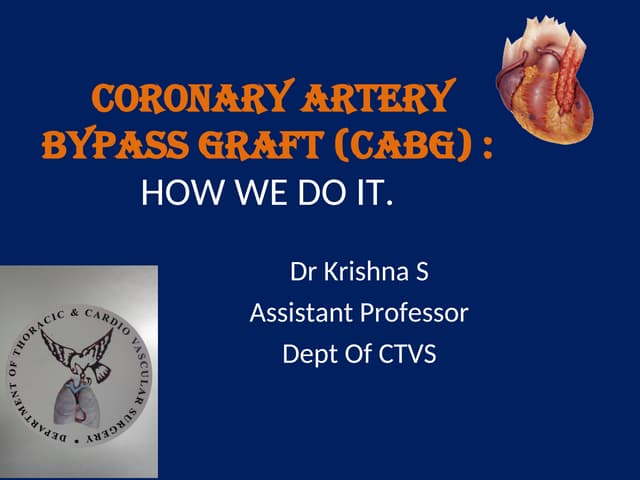 ICD-10-PCS Coding Guidelines for Coronary Arterial Bypass Procedures | PDF