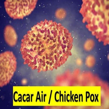 Cacar Air.pptx