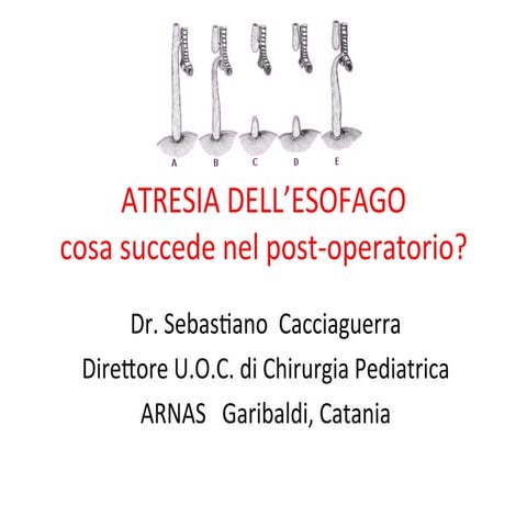 Atresia Esofagea - Cosa succede nel postoperatorio? | PDF