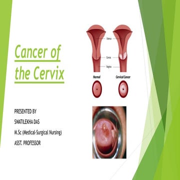CANCER of Cervix- Easy ppt for Nurses | PDF