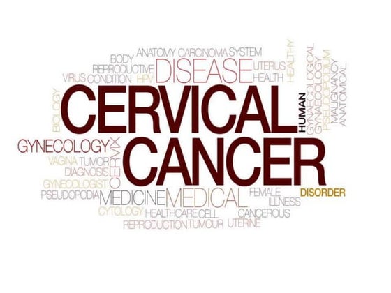 CARCINOMA CERVIX | PPT