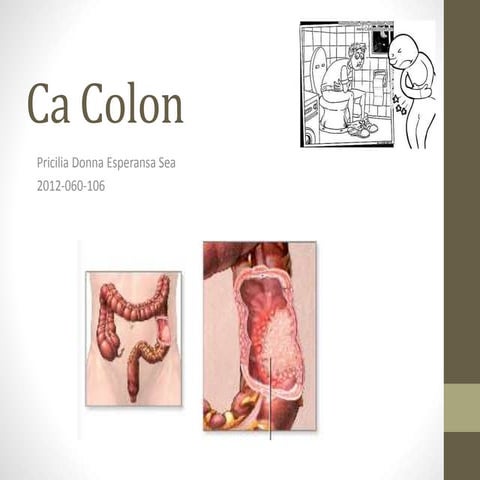 Ca Colon | PPTX
