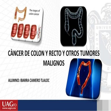 CÁNCER DE COLON Y RECTO digestivoCIRUGIA.pptx