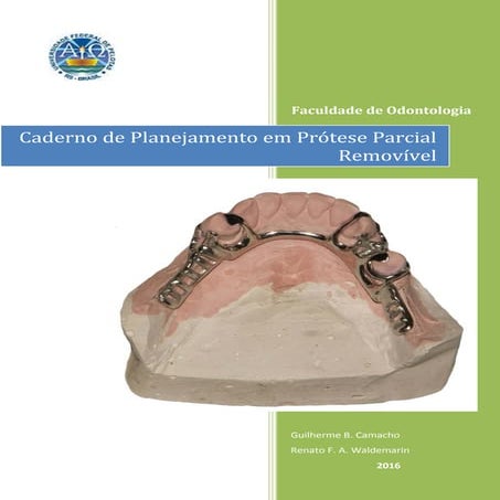 Prótese Parcial Removível Odontológico | PDF