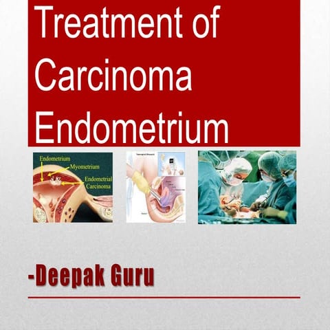 treatment of Ca Endometrium | PPTX
