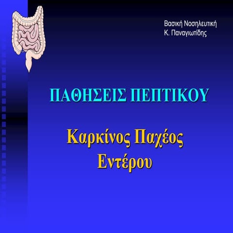 Καρκίνος Παχέος εντέρου | PPTX