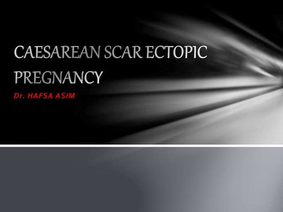 Lower segment ceasarean section(lscs) | PPTX