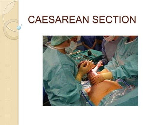 Caesarean section | PPT