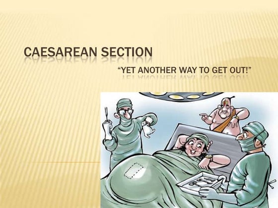 Caesarean section | PPT