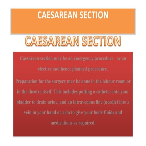 Caesarean section | PPTX