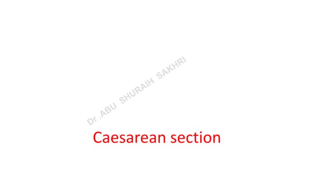 Caesarean section | PPTX
