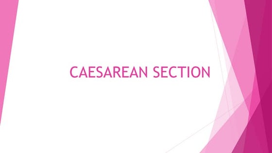 Lower segmental caesarian section tray | PPT