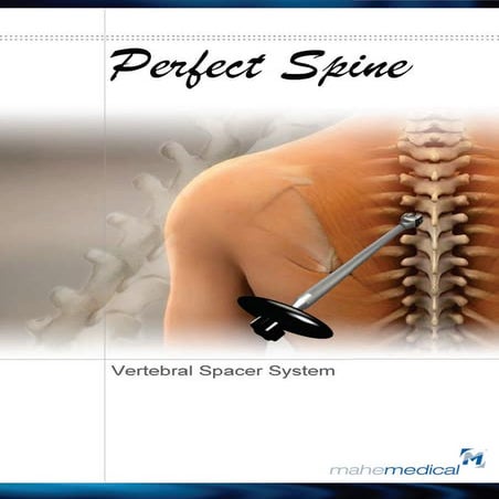 Interbody Fusion Cages | PDF