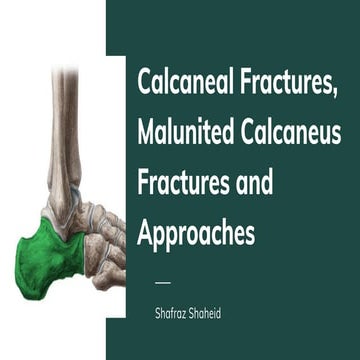 Malunited Calcaneus Fractures | PDF