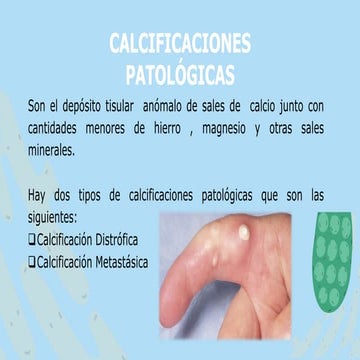 CALCIFICAIONES patologia medicina ryc.pptx