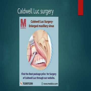 Caldwell Luc surgery.pptx