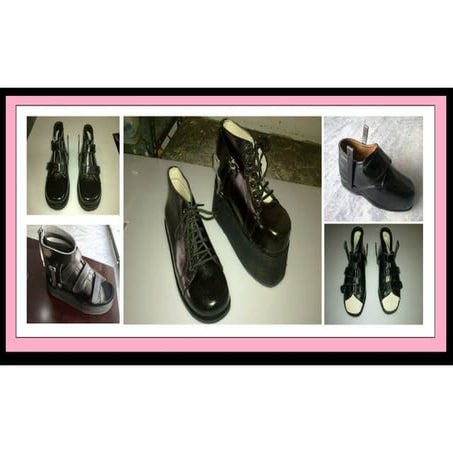 Caliper shoes for polio patients @ My Care Prosthetics and Orthotics | PDF