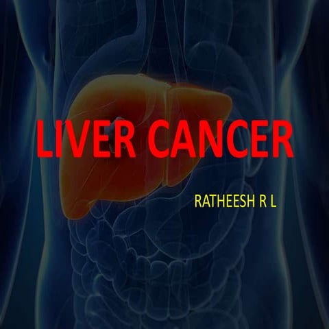 Ca liver | PPTX