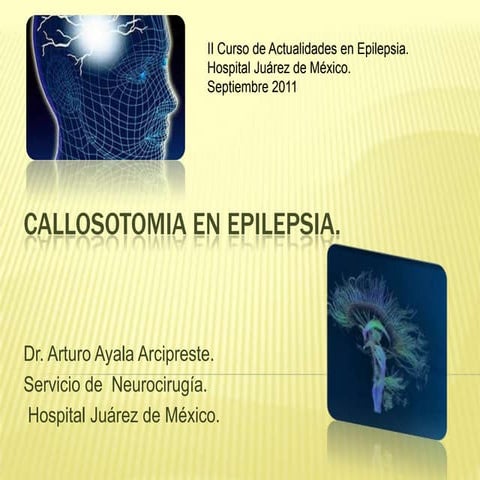 Hidrocefalia e indice de Evans. Arturo Ayala-Arcipreste MD FAANS | PPTX