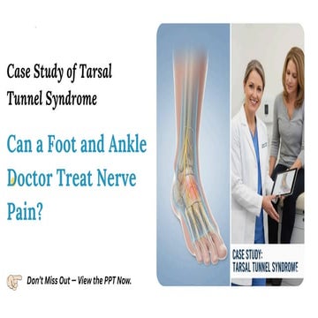 Can a Foot and Ankle Doctor Treat Nerve Pain? Case Study of Tarsal ...