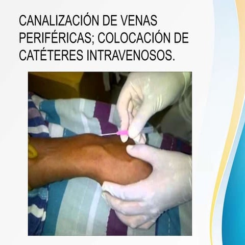 VENOCLISIS CONCEPTO VIAS PERIFERICAS Y CALIBRES DE CATETER | PPTX