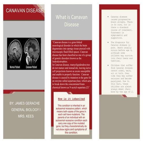 Canavan disease (1) | DOCX