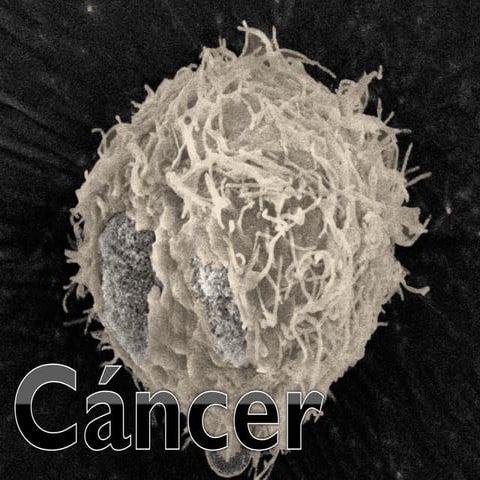 HALLMARKS OF CANCER , definicion, caracteristicas. | PPTX