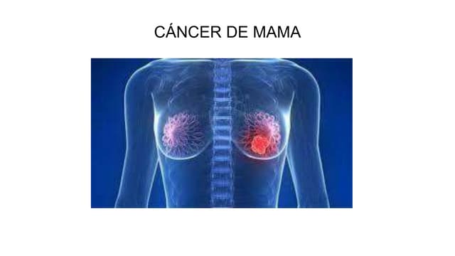 Cancer De Mamapptx