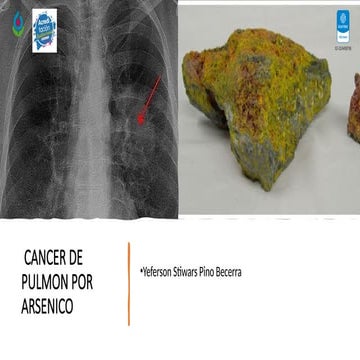 CANCER DE PULMON POR ARSENICO DIAPOSITIVAS.pptx
