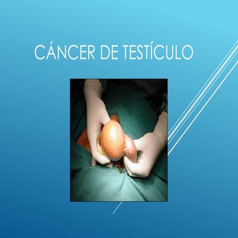 CANCER DE TESTICULO 1.pptxCANCER DE TESTICULO 1.pptx