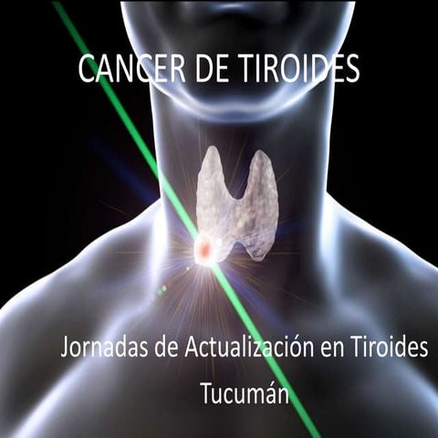 Cáncer de tiroides ATA 2025 (CDT) | PDF