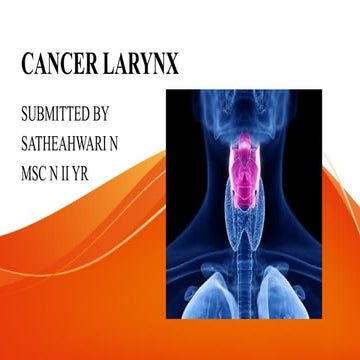 CANCER OF LARYNX AND ITS DETAILED MANAGEMENT | PPTX