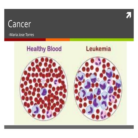 Cancer leukemia | PPT