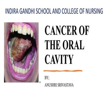 CANCER OF THE ORAL CAVITY.pdf