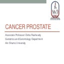 Cancer prostate | PPTX