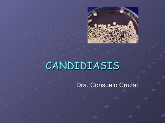 Candidiasis – clinical manifestations and lab diagnosis of oral ...