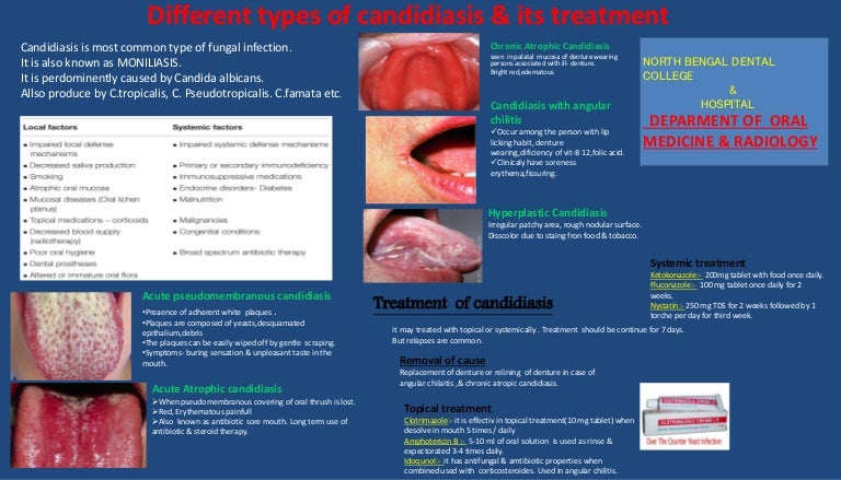 Oral Candidiasis Symptoms And Signs