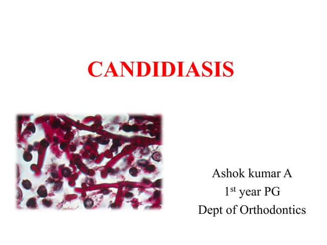 Candida | PPTX | Skin and Dermatology | Diseases and Conditions