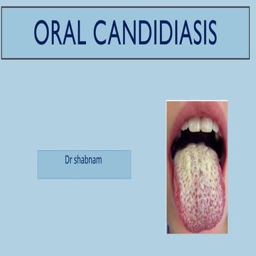 Oral Candidiasis: Clinical Features, Diagnosis and Management – By Dr ...