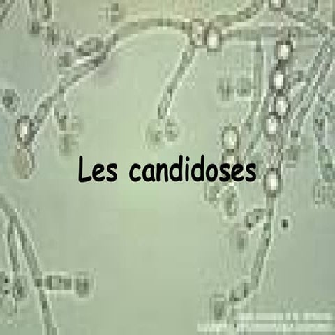Candidose buccal | PPT