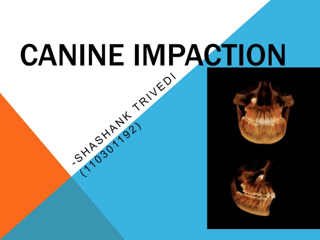 CANINE IMPACTION 1.pptx