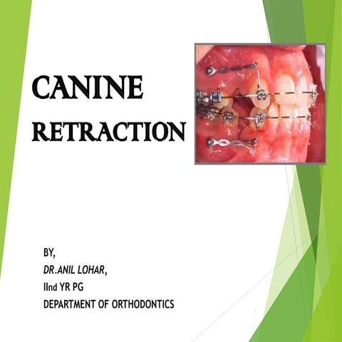 Comprehensive Overview of Canine Retraction in Orthodontics ...