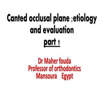Canted occlusal plane ; etiology and evaluation part 1 | PPTX
