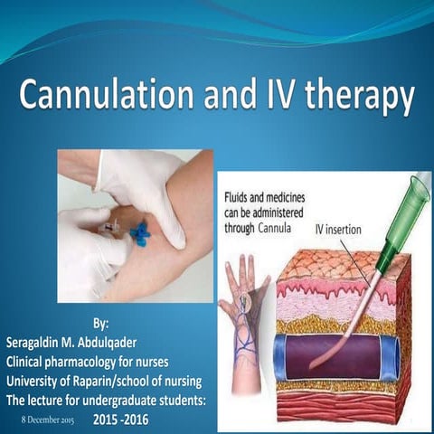 Iv cannulation sites | PDF