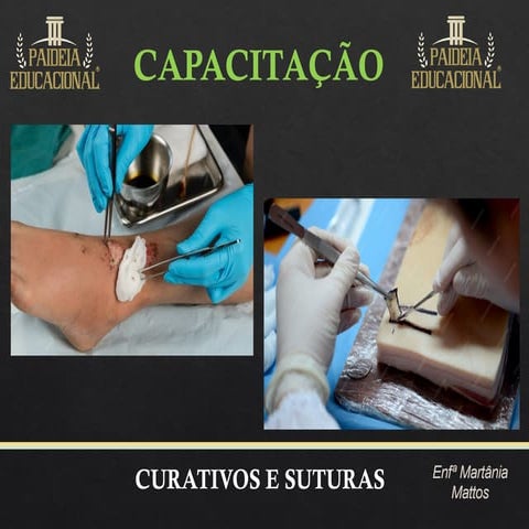 Teste de Atenção Difusa - Tadim tedif | PDF